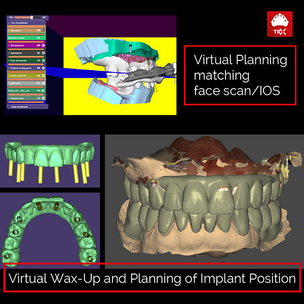 Dr. Alexis Ioannidis: Precision and Immediacy: Dual Scan Techniques for ...