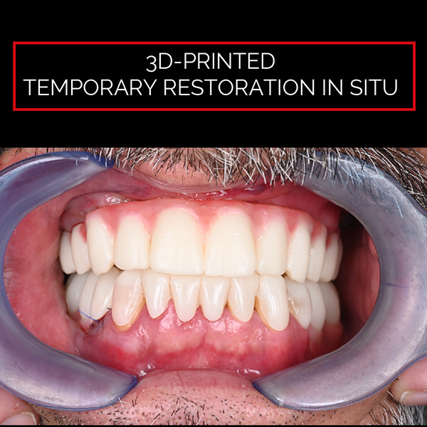 Dr. Alexis Ioannidis: Precision and Immediacy: Dual Scan Techniques for ...